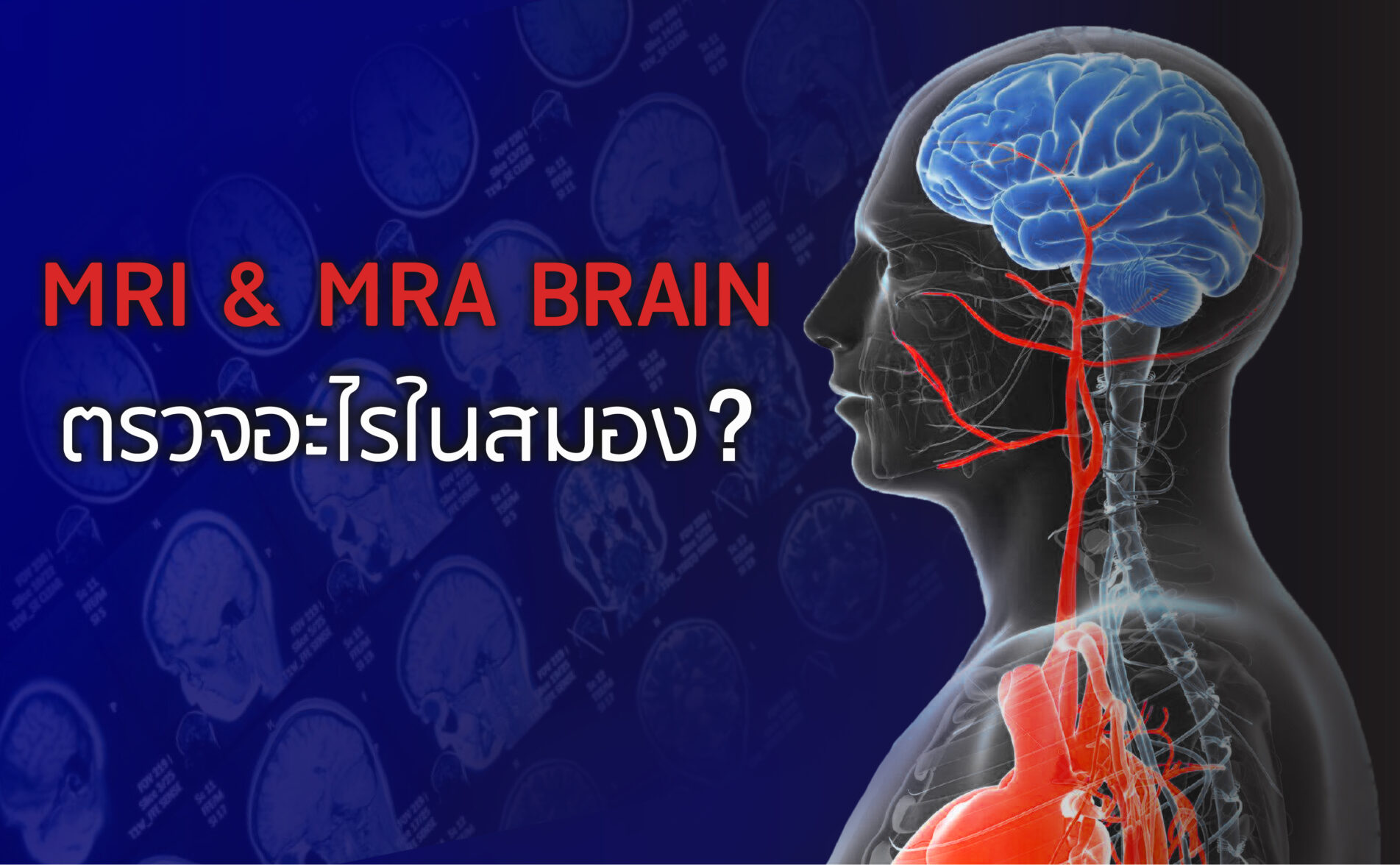 MRI & MRA Brain ตรวจอะไรในสมอง? – ประชาชื่น MRI